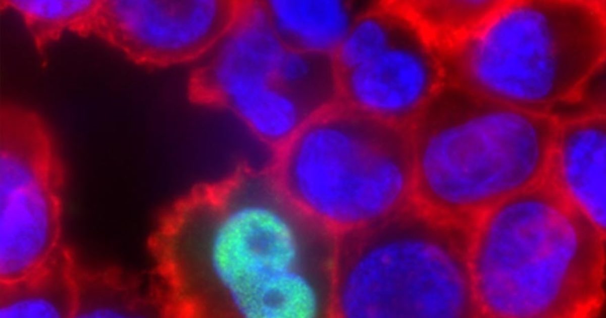 Cancer Data Science Group | CMRI