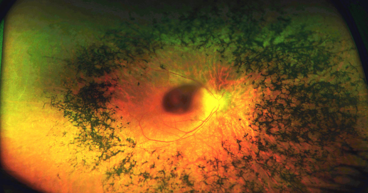 First major map of stem cells for retinal eye diseases | CMRI