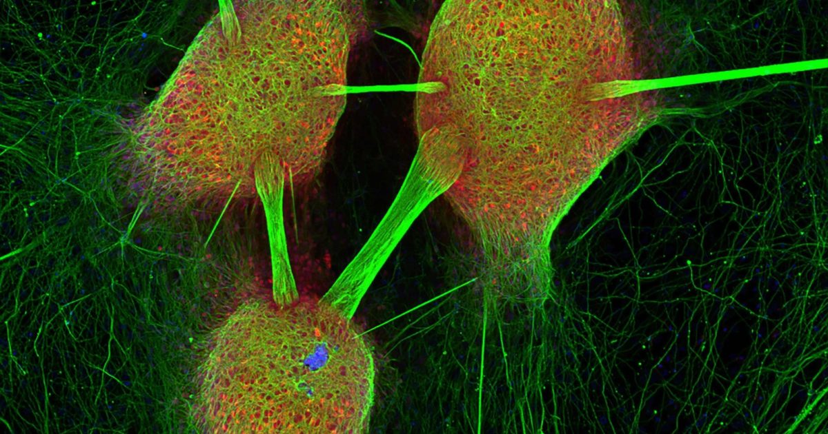 Neural Organoids | CMRI