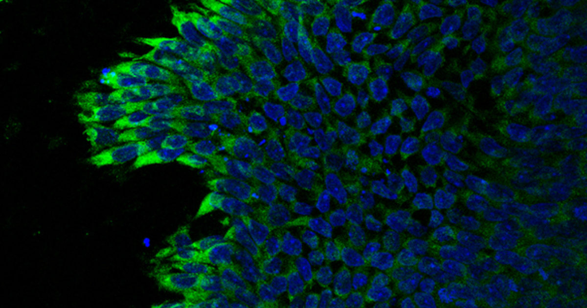 Maintenance of iPS cell lines | CMRI