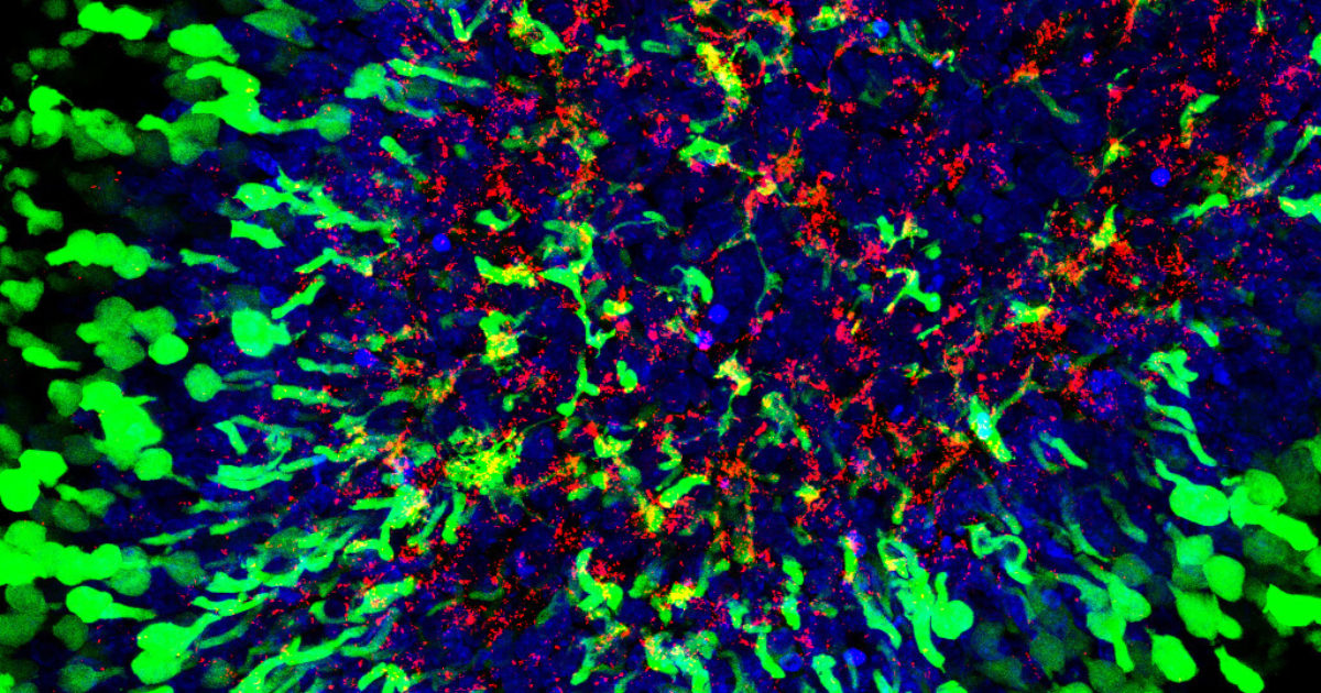 Cardiac Organoids | CMRI