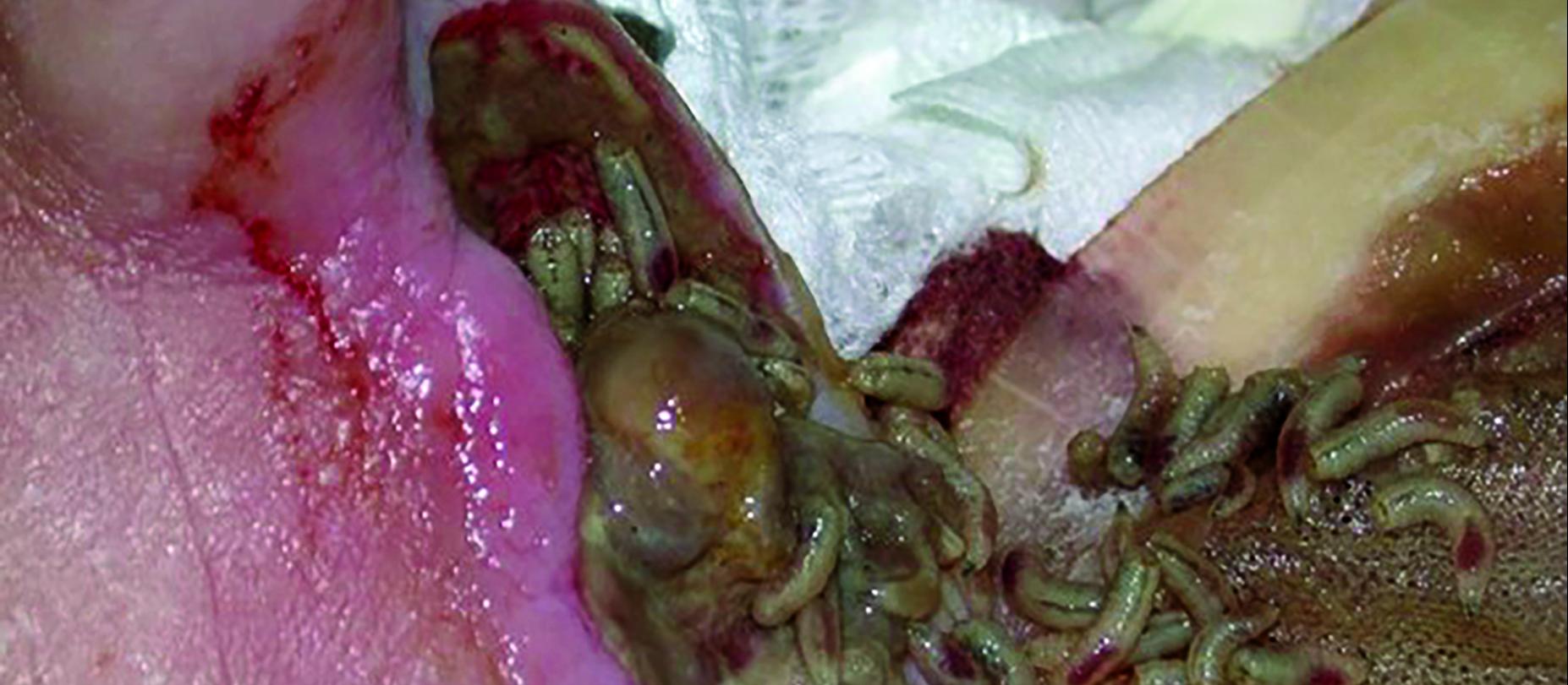 debridement using maggots