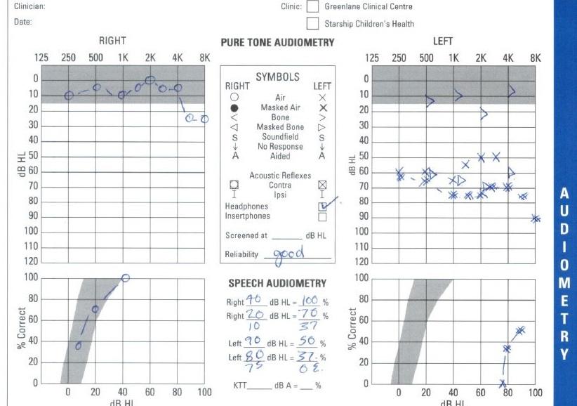 hearing loss case study examples