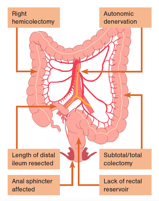 terminal ileum function
