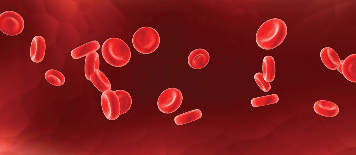 Iron deficiency: Diagnosis and comprehensive management strategies ...