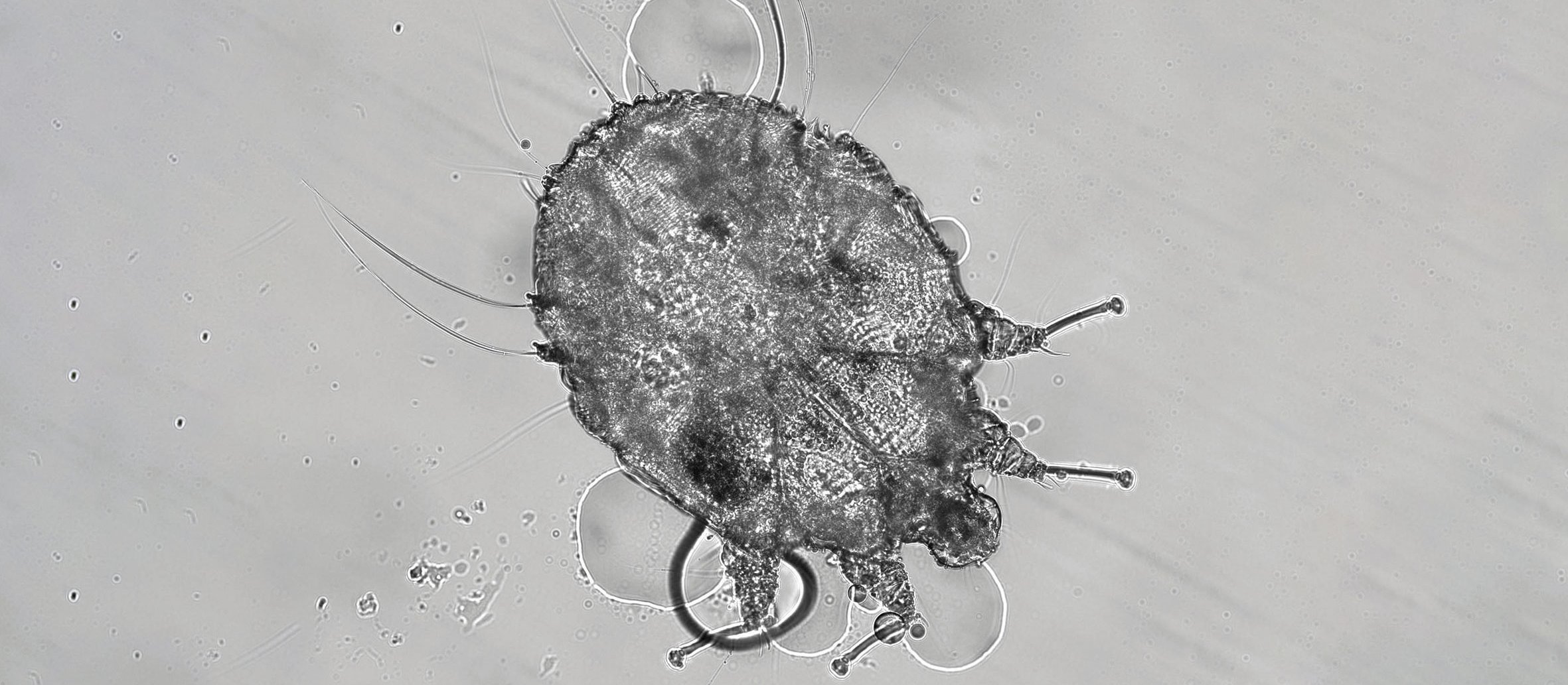 Scabies: Don’t ignore the itch | Pharmacy Today