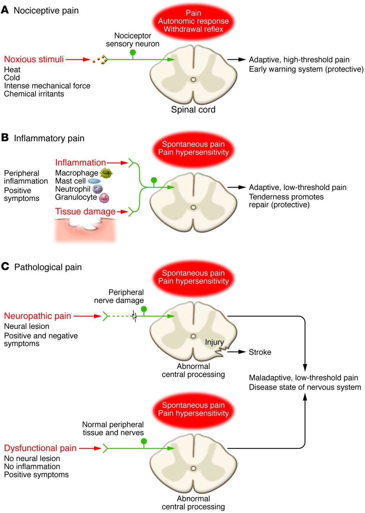 CLASStime: Persistent pain | Pharmacy Today