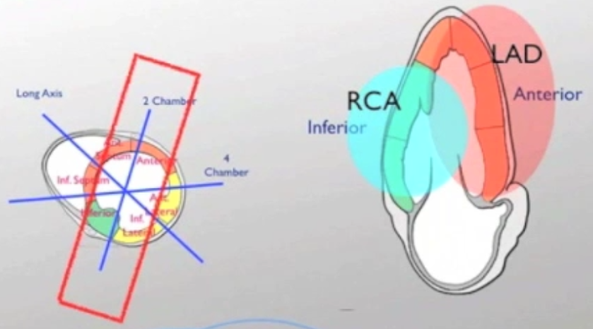 File:Apical Two Chamber View.png - WikEM