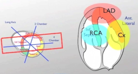 Formal echocardiography - WikEM