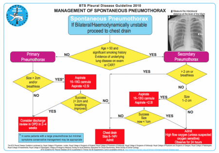 Spontaneous pneumothorax - WikEM