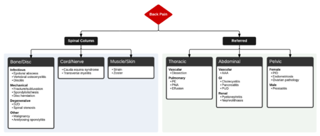 Lower back pain - WikEM