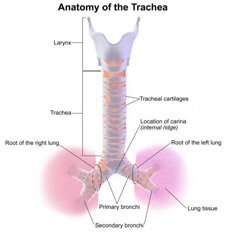 Bacterial tracheitis - WikEM