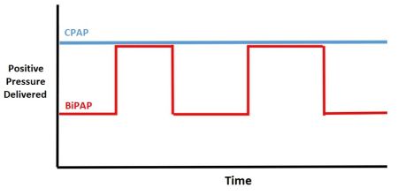 Noninvasive ventilation - WikEM