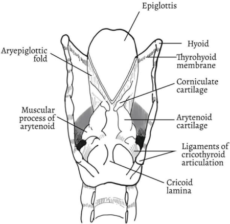 Supraglottic airway - WikEM