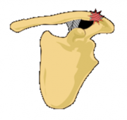 Acromioclavicular joint injury - WikEM
