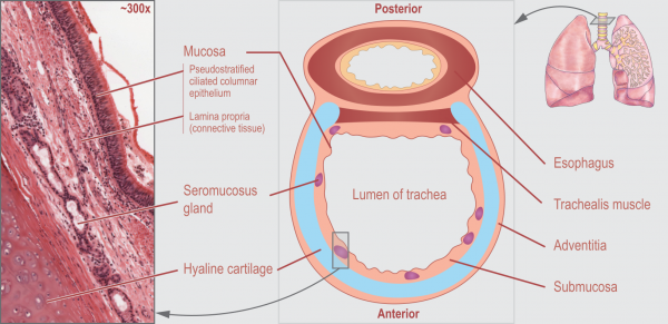 Tracheomalacia - WikEM