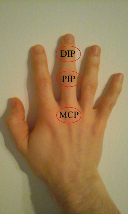 Hand and finger infections - WikEM
