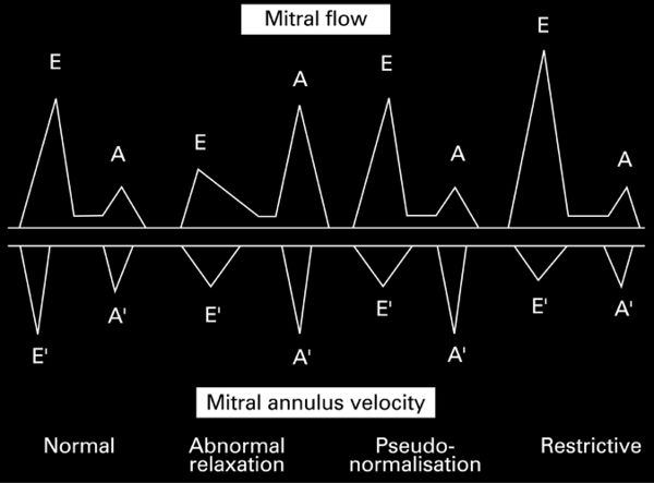 Formal echocardiography - WikEM