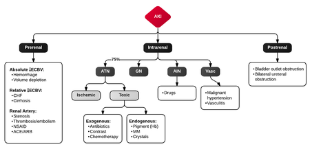 Acute kidney injury - WikEM