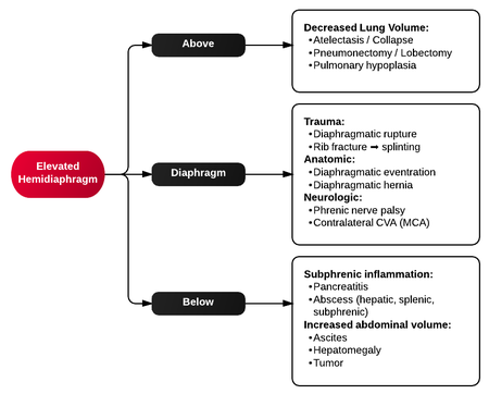 Chest x-ray interpretation - WikEM
