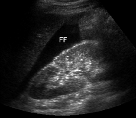 Abdominal trauma - WikEM