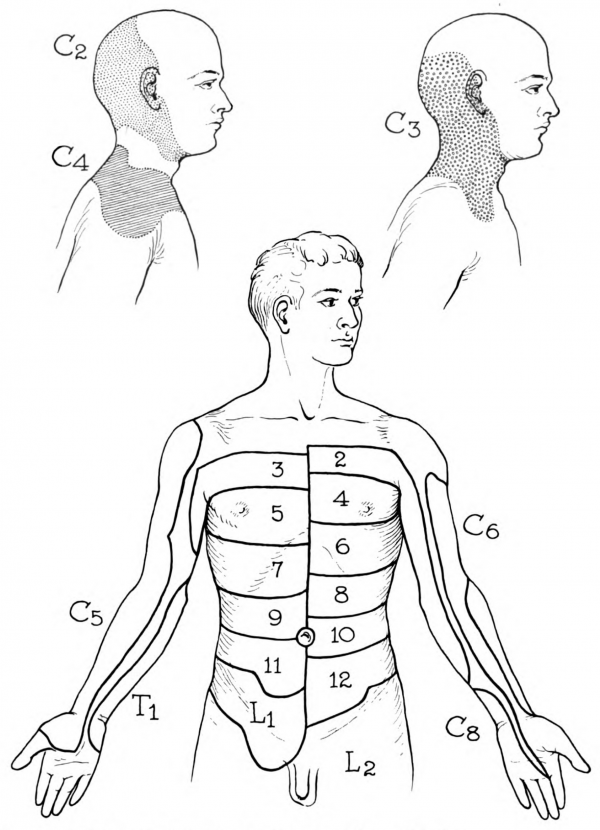 Cervical radiculopathy - WikEM