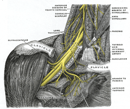 Long thoracic neuropathy - WikEM