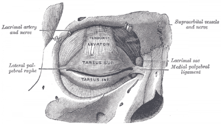 Nerve Block: Supraorbital - WikEM