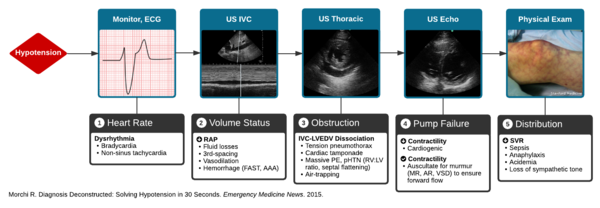Undifferentiated shock - WikEM