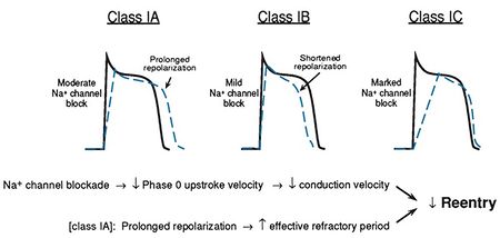 Procainamide - WikEM