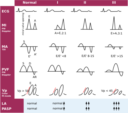 Formal echocardiography - WikEM