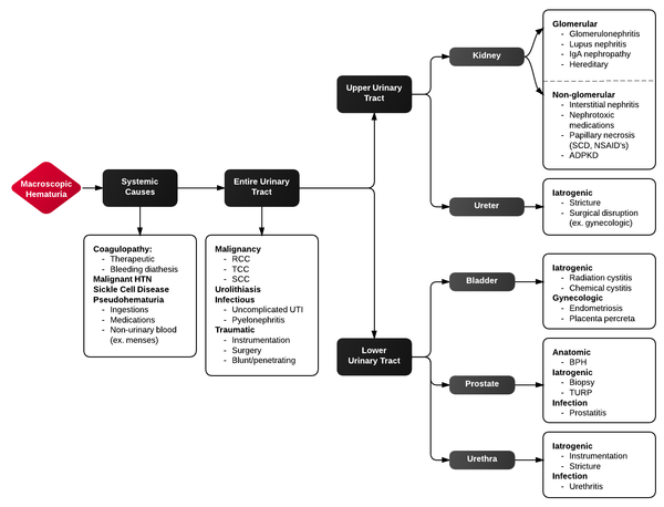 Hematuria - WikEM
