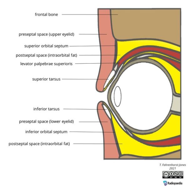 Periorbital swelling - WikEM