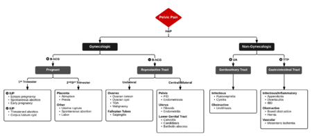 Pelvic inflammatory disease - WikEM