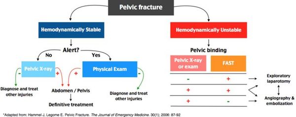 Pelvic fractures - WikEM
