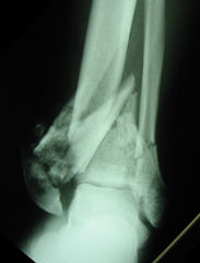 Category:Orthopedics - WikEM