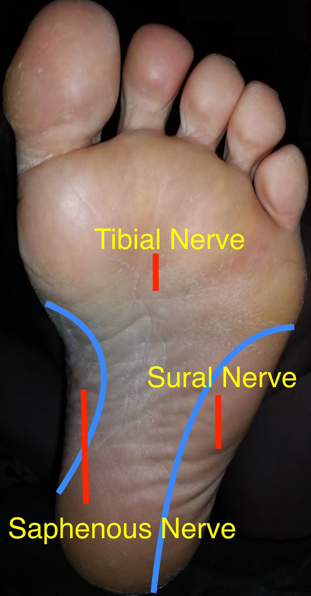 File:Plantar Nerve Distribution.jpg - WikEM