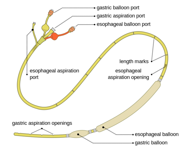 Balloon tamponade for massive GI bleeding - WikEM