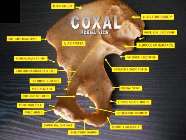 Acetabular pelvic fractures - WikEM