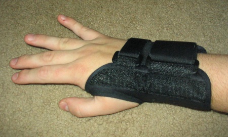 Carpal tunnel syndrome - WikEM