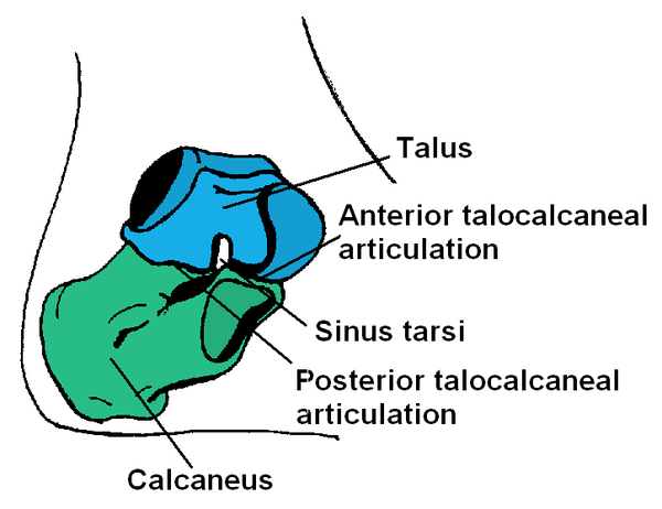 Talus fracture - WikEM