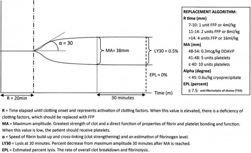 Thromboelastography (TEG) - WikEM