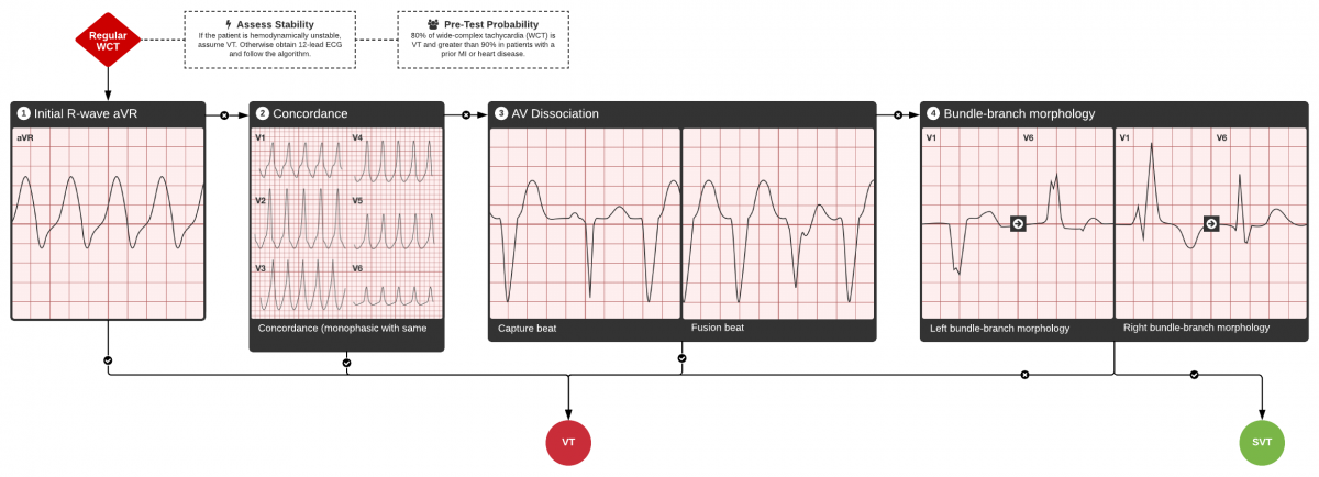 File:Wide Complex Tachycardia.png - WikEM